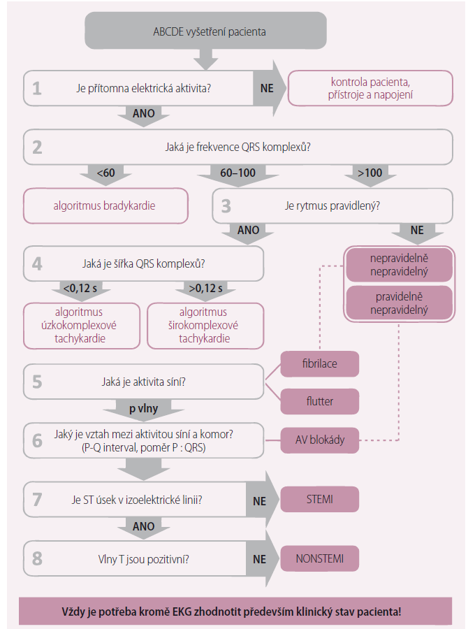EKG dia­gnostika prvn... | Kardiologická revue – Interní medicína